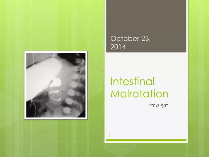 PPT - Intestinal Malrotation PowerPoint Presentation, free download ...