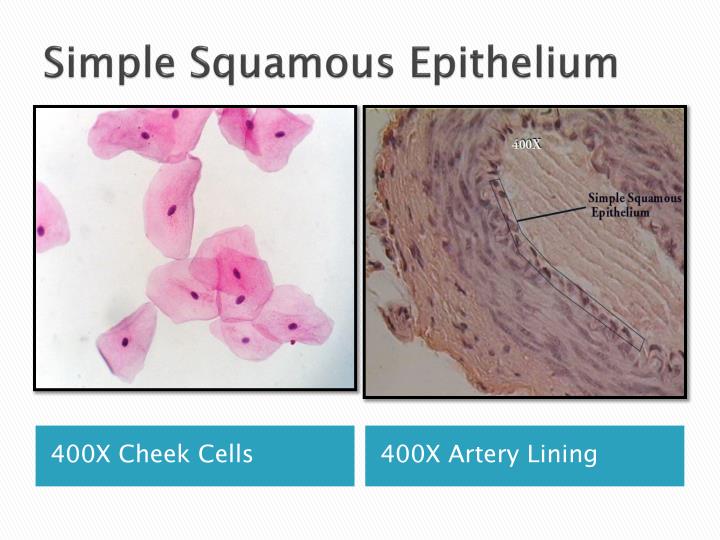 Simple Squamous Epithelium 400x