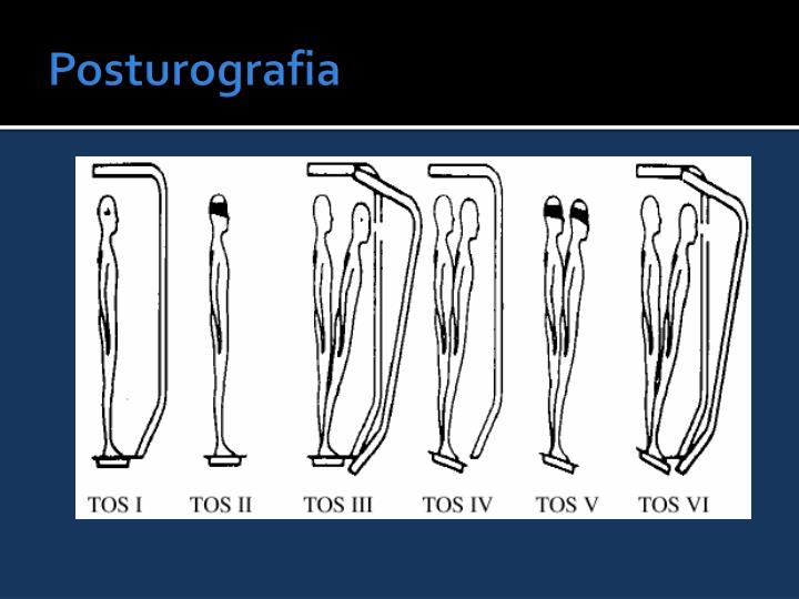 PPT - POSTURA E EQUILÍBRIO PowerPoint Presentation - ID:5751138