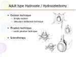 PPT - Surgical Treatment of Hydrocele & Hernia PowerPoint Presentation ...