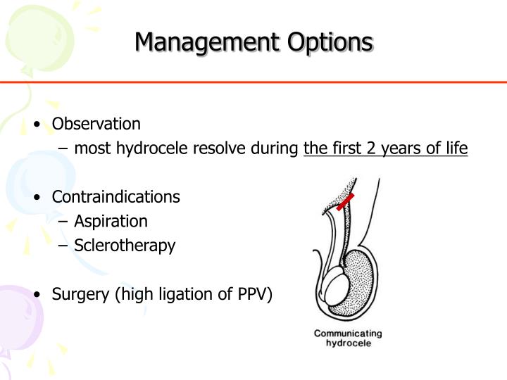PPT - Surgical Treatment of Hydrocele & Hernia PowerPoint Presentation ...