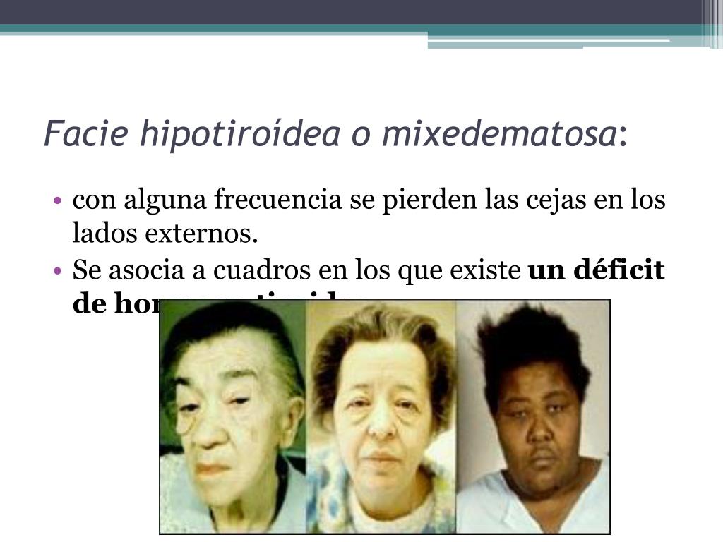 PPT - Examen físico general: Facie y expresión de la fisonomía ...