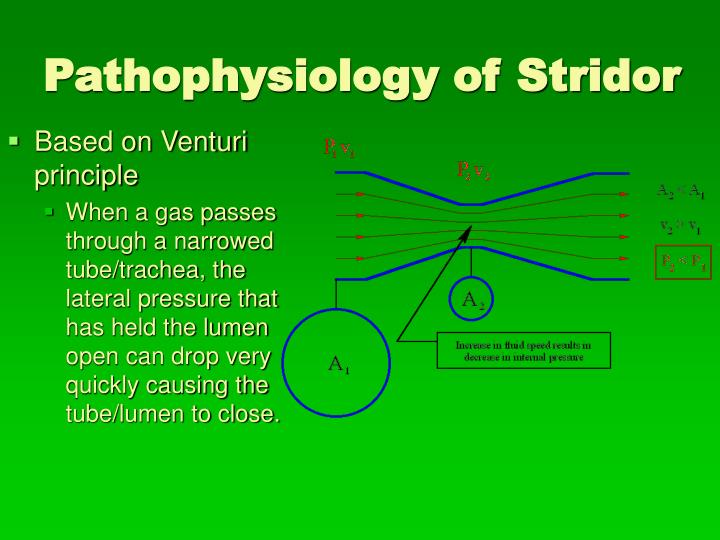 PPT - Stridor in Child PowerPoint Presentation - ID:5754177