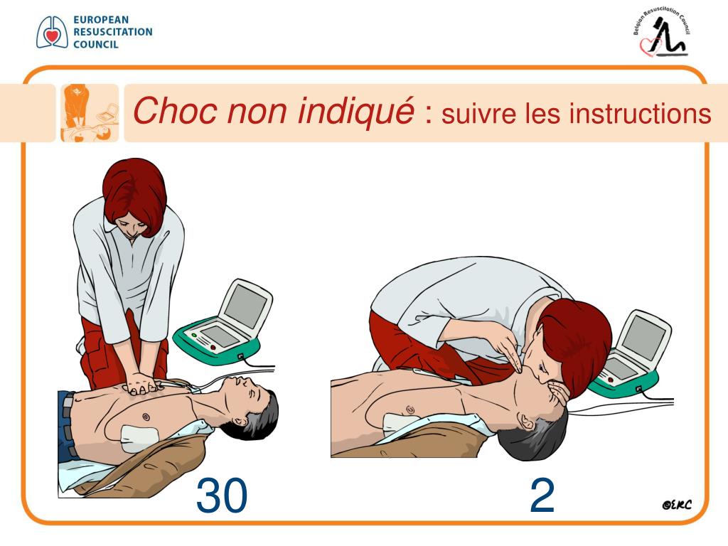 PPT - REANIMATION CARDIO-PULMONAIRE avec DEFIBRILLATEUR EXTERNE ...