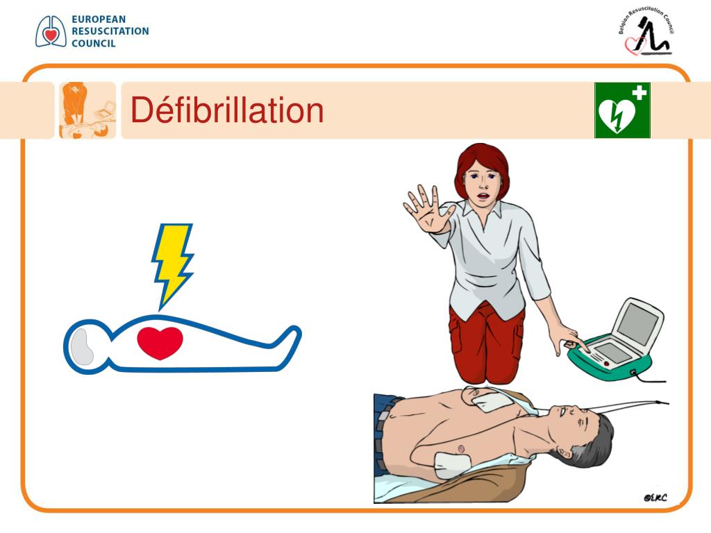 PPT - REANIMATION CARDIO-PULMONAIRE avec DEFIBRILLATEUR EXTERNE ...