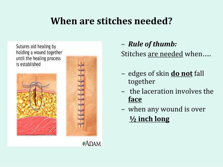 PPT - First Aid: PowerPoint Presentation - ID:5767765