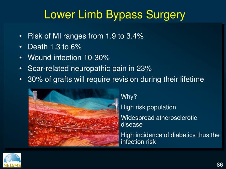 PPT - Peripheral Arterial Disease: Simulation Training Curriculum ...