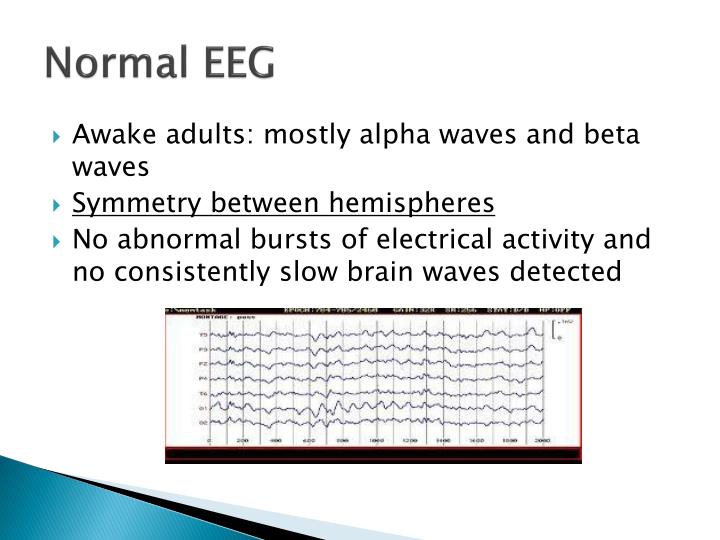 PPT - Neurologic Studies PowerPoint Presentation - ID:5770427
