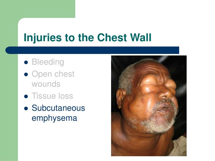 PPT - Thoracic Trauma PowerPoint Presentation - ID:5773450