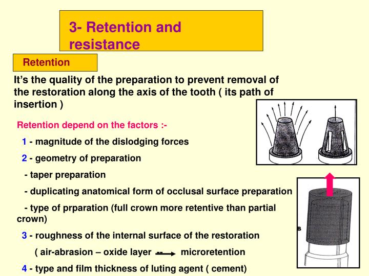 PPT - Tooth preparation PowerPoint Presentation - ID:5775028