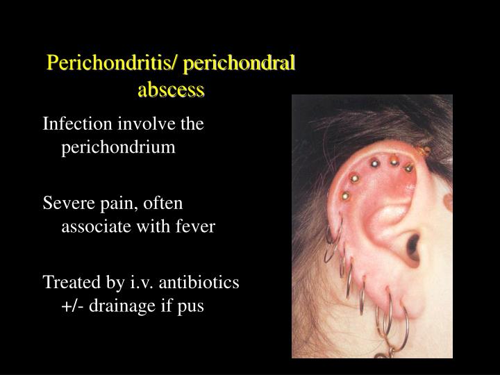 PPT - Diseases of External Ear PowerPoint Presentation - ID:5775117