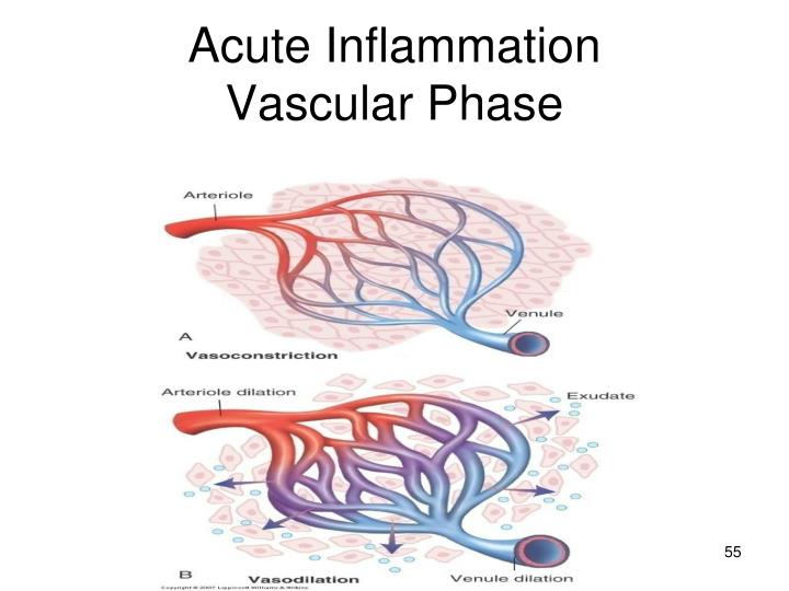 PPT - The Immune Response: PowerPoint Presentation - ID:5775190