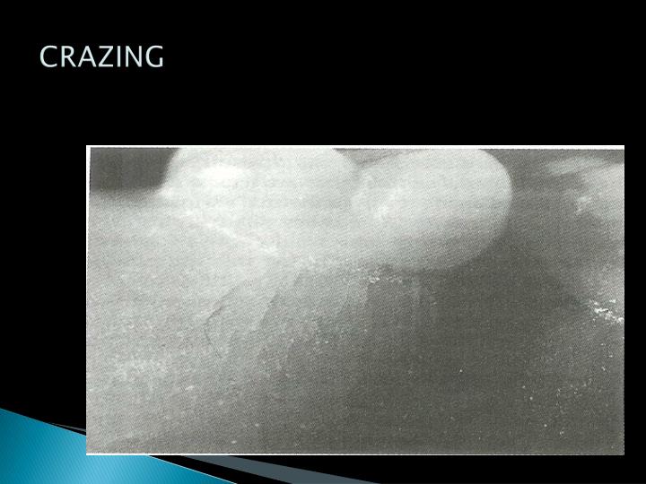 PPT - DENTURE BASE RESINS PowerPoint Presentation - ID:5778801