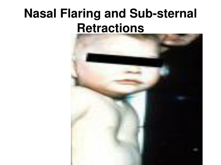 PPT - RSPT 2353 Neonatal Pediatric Respiratory Care PowerPoint ...