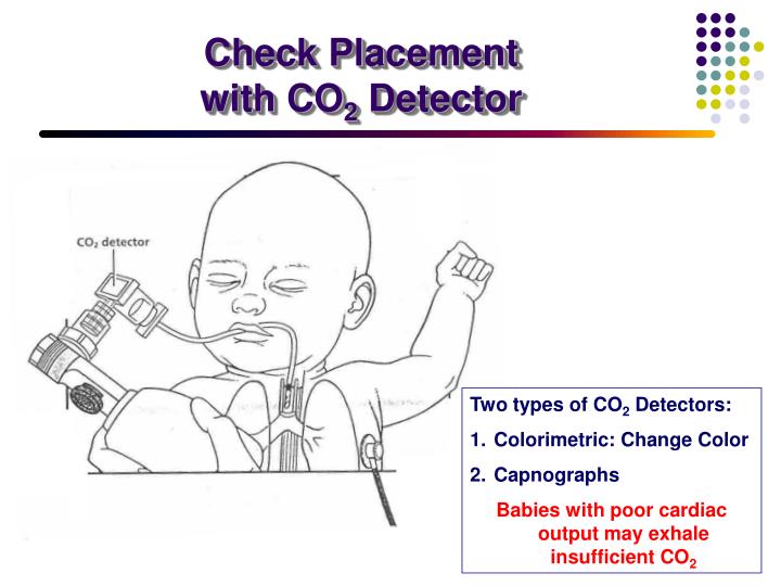 PPT - Endotracheal Intubation PowerPoint Presentation - ID:5780948