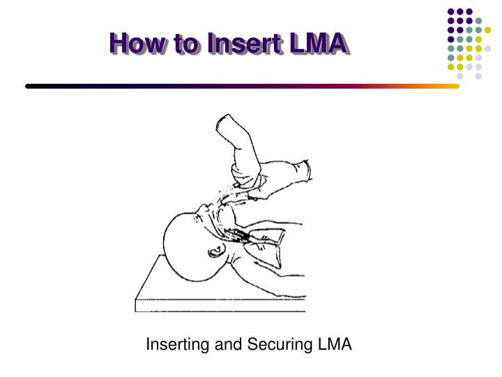 PPT - Endotracheal Intubation PowerPoint Presentation - ID:5780948