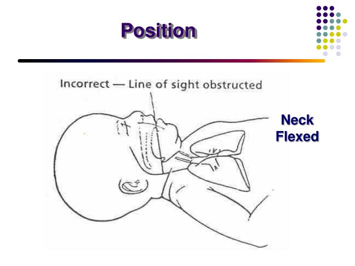 PPT - Endotracheal Intubation PowerPoint Presentation - ID:5780948