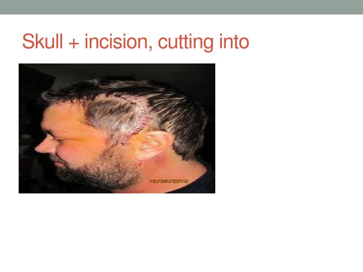 PPT - Medical Terminology PowerPoint Presentation - ID:5782155