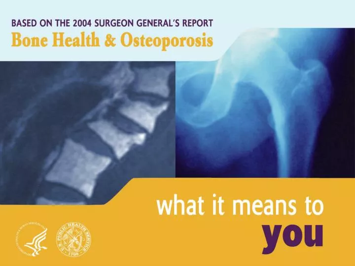 PPT - Your Bone Health is at Risk PowerPoint Presentation, free ...
