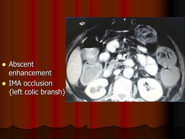 PPT - Bowel Ischemia PowerPoint Presentation - ID:5787723