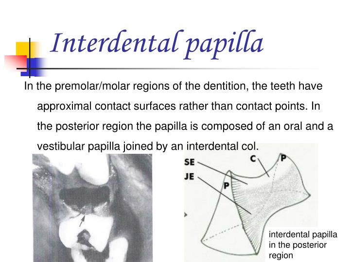 PPT - Pre-clinical Periodontics PowerPoint Presentation - ID:5788556