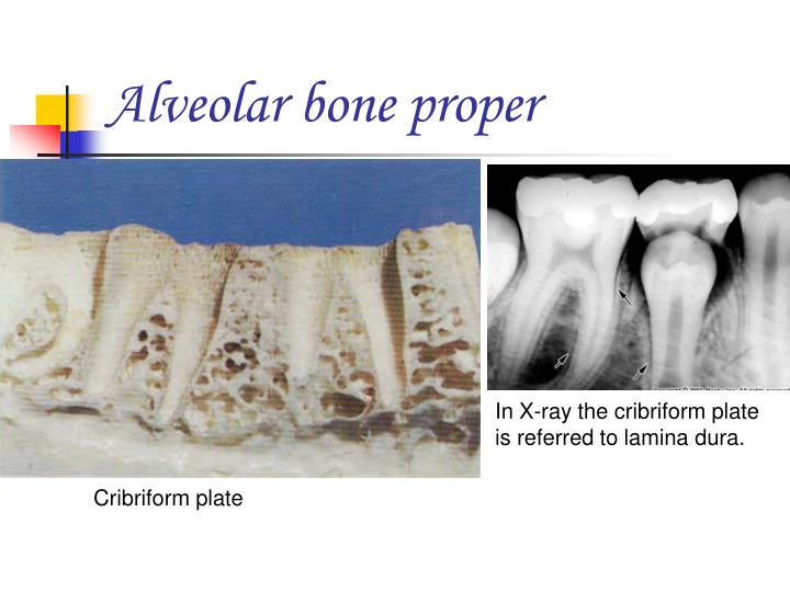 PPT - Pre-clinical Periodontics PowerPoint Presentation - ID:5790245
