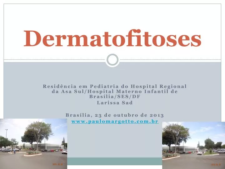 PPT - Dermatofitoses PowerPoint Presentation, free download - ID:5791555