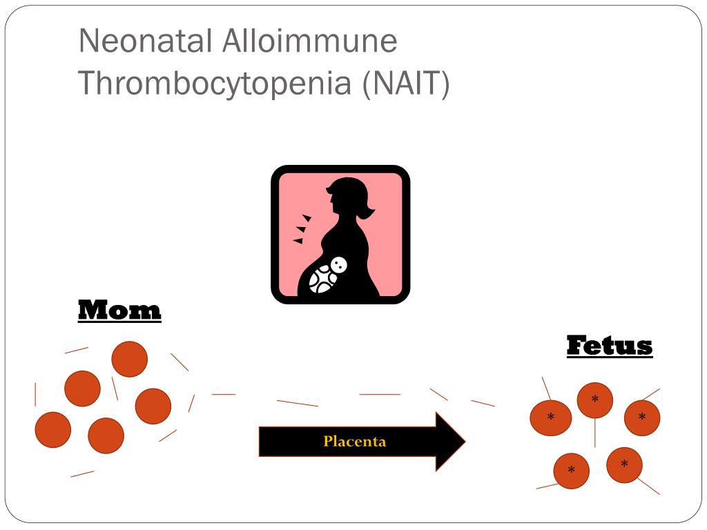 Ppt Neonatal Thrombocytopenia Powerpoint Presentation Free Download