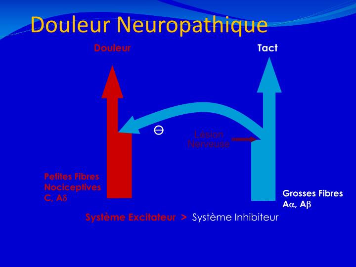 PPT - Douleurs neuropathiques chroniques. 2009.LA REUNION. Dr MANZO ...