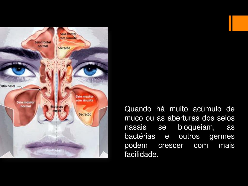 PPT - CIE – CENTRO DE EDUCAÇÃO PROFISSIONAL INTEGRADO TÉCNICO DE ...