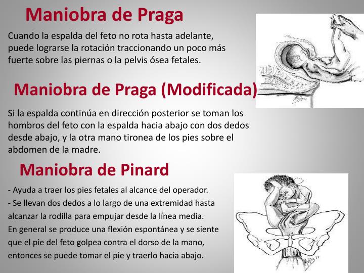 PPT - PARTO PODÁLICO PowerPoint Presentation - ID:5798311