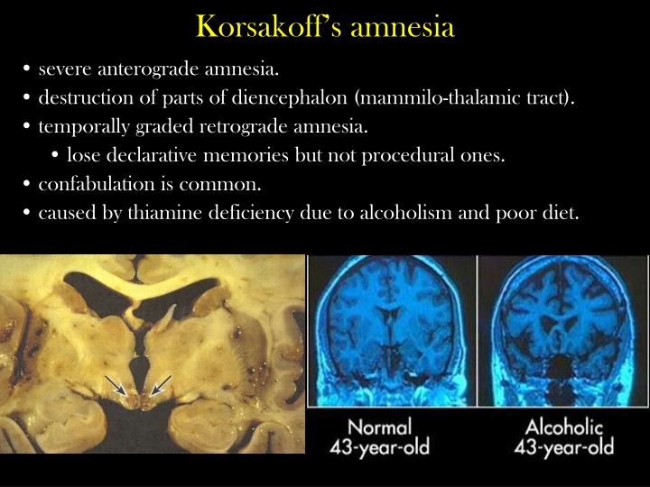 PPT - Disorders of Memory Amnesia & Animal Models PowerPoint ...