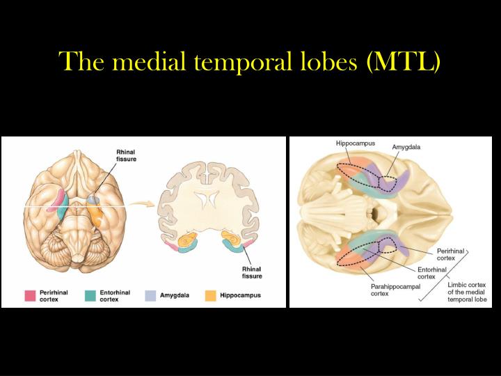 PPT - Disorders of Memory Amnesia & Animal Models PowerPoint ...