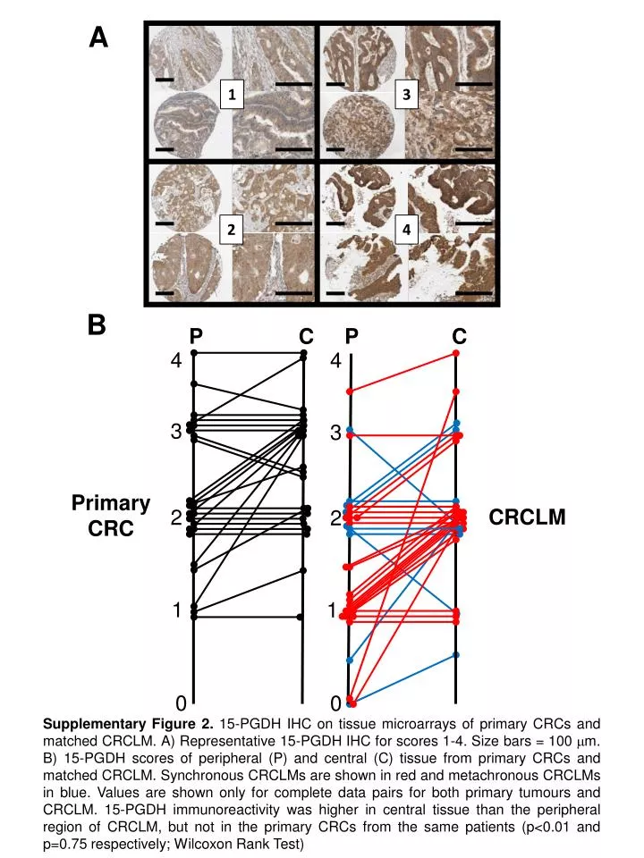 PPT - Primary CRC PowerPoint Presentation, free download - ID:5801241