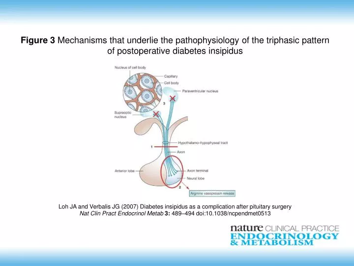 PPT - Loh JA and Verbalis JG (2007) Diabetes insipidus as a ...