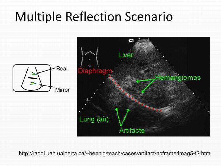 PPT - Ultrasound Physics PowerPoint Presentation - ID:5831119