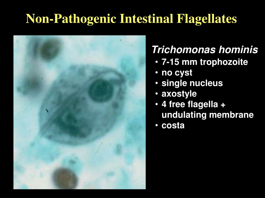 PPT - Flagellates : Giardia lamblia Dientamoeba fragilis Chilomastix ...