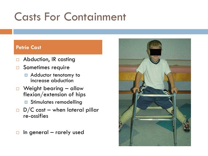 PPT - LegG -Calve- Perthes Disease PowerPoint Presentation - ID:5839224