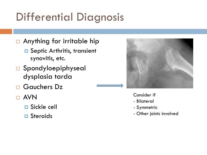 PPT - LegG -Calve- Perthes Disease PowerPoint Presentation - ID:5839224