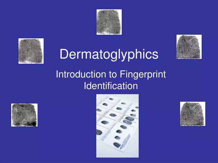 PPT - Dermatoglyphics PowerPoint Presentation, free download - ID:5840502
