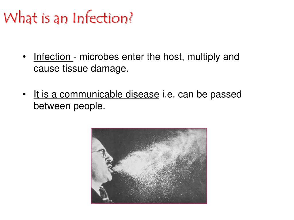 PPT - Microbiology 2 Infection Control DN8 PowerPoint Presentation ...