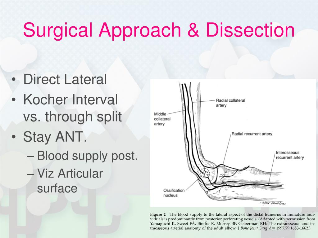 PPT - Lateral Condyle Fractures Sasha Carsen Nov 29 th , 2012 ...
