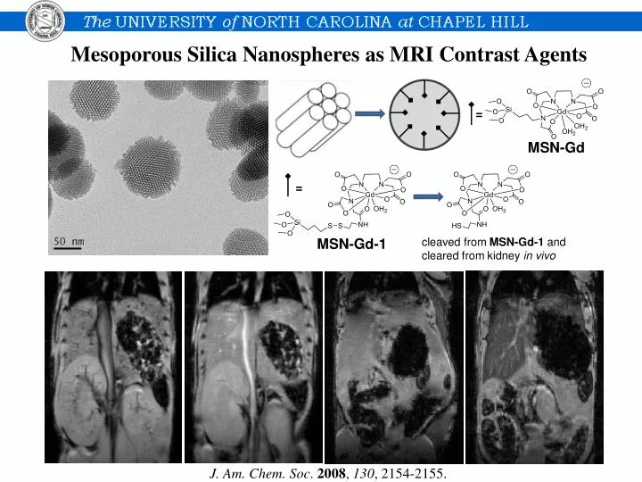 PPT - Mesoporous Silica Nanospheres as MRI Contrast Agents PowerPoint ...