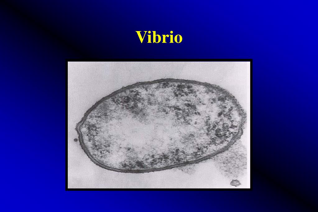 PPT - Cholera and other Vibrio Infections PowerPoint Presentation, free ...