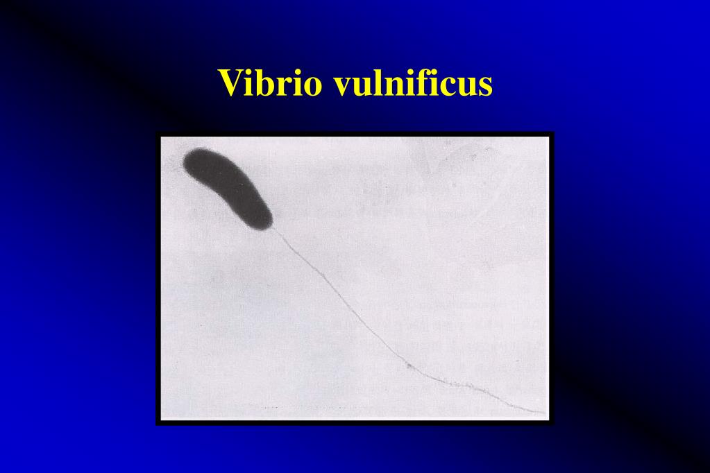 PPT - Cholera and other Vibrio Infections PowerPoint Presentation, free ...