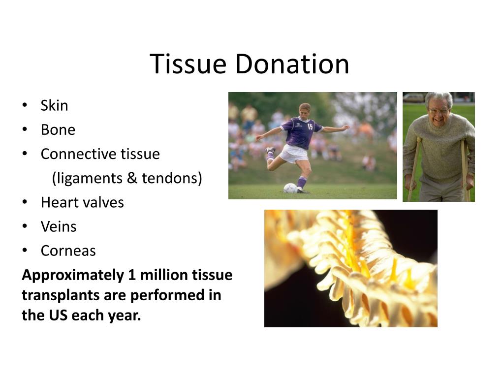PPT - Donate Life: An Overview of Organ, Tissue and Eye Donation ...