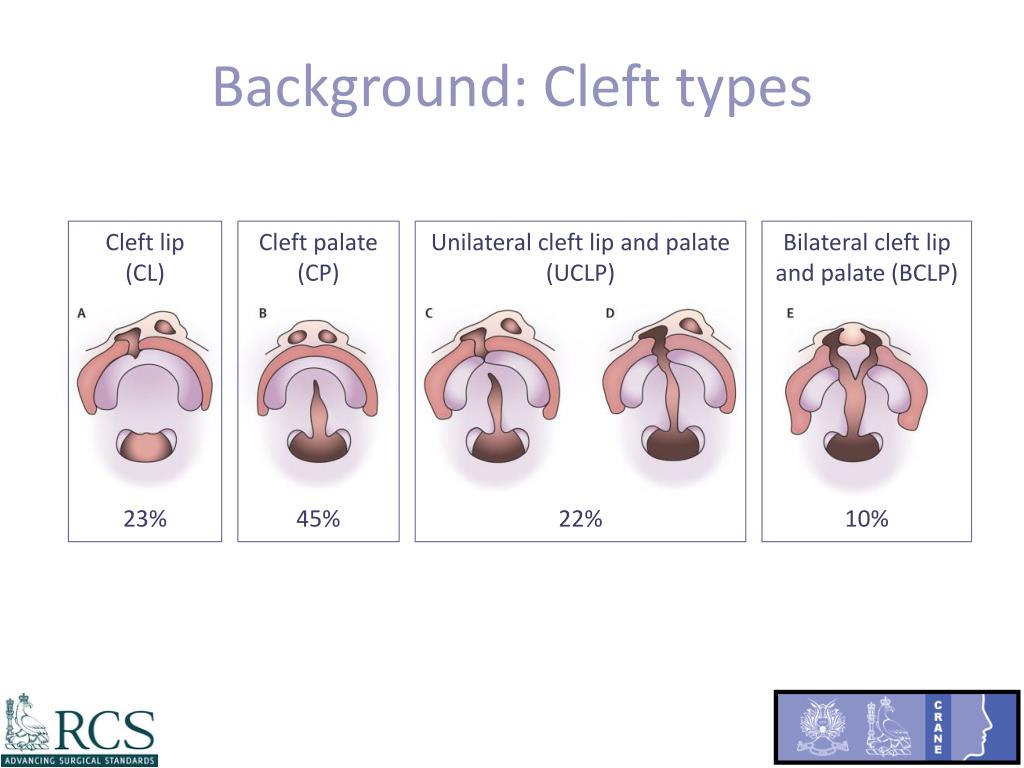 PPT - Linking CRANE and NPD for Educational Outcomes in Children with ...