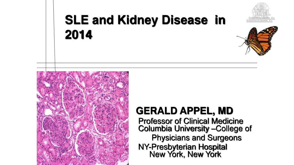 PPT - SLE and Kidney Disease in 2014 GERALD APPEL, MD PowerPoint ...