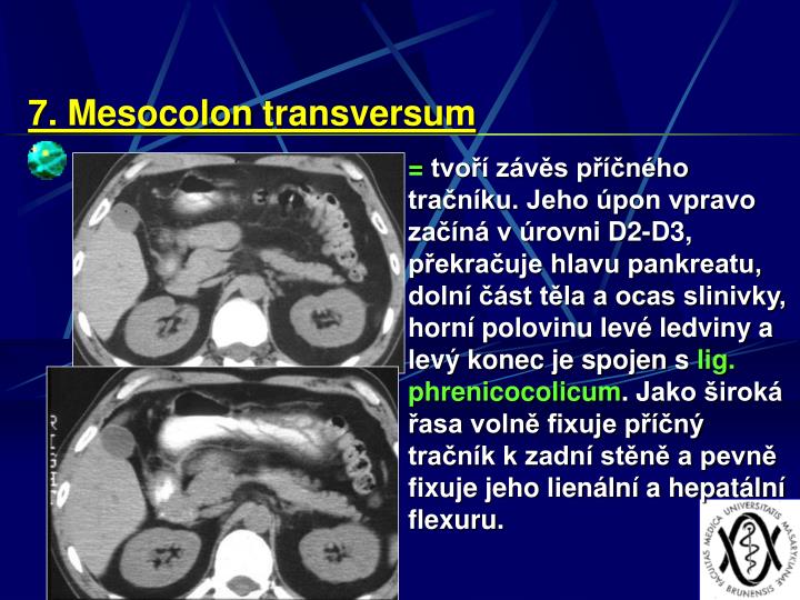 PPT - Mesenterium a peritoneum PowerPoint Presentation - ID:5857858