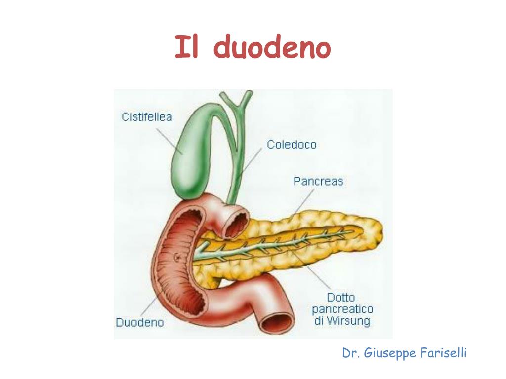 PPT - Il carcinoma intestinale PowerPoint Presentation, free download ...